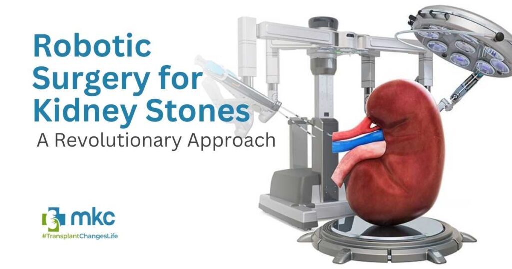 Robotic Surgery for Kidney Stones: A Revolutionary Approach | MKC